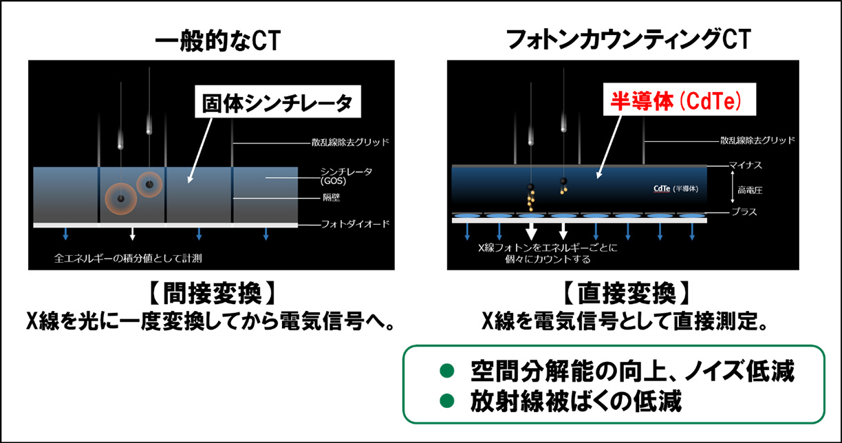 次世代CTの導入と世界初のシステム構築による高精度な画像診断─より効果的な診療に向けた放射線科の取り組み─ - Online ...